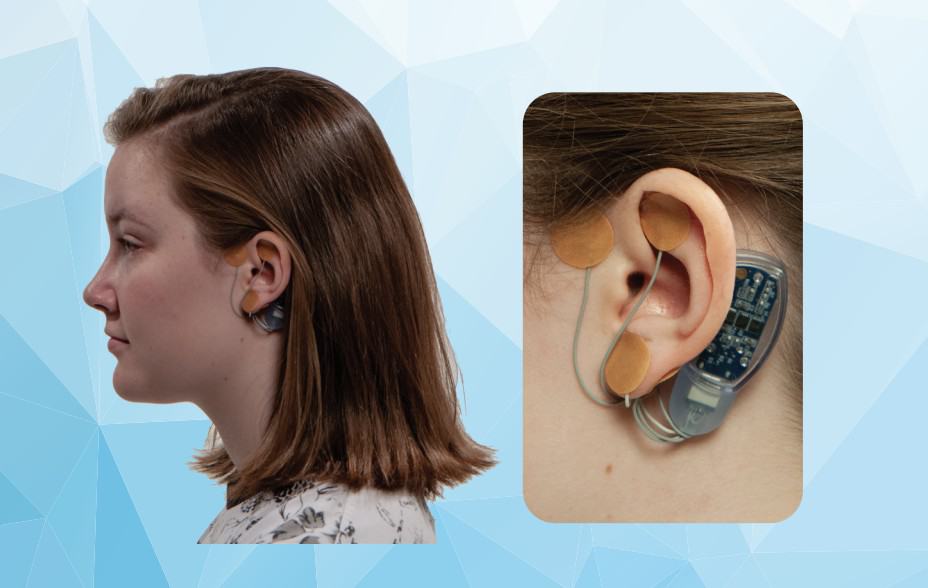 Functional IBS Pain in Adolescents - New Non-Drug Intervention Gives ...